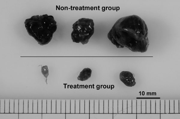 GcMaf Benefits For Cancer (2024)