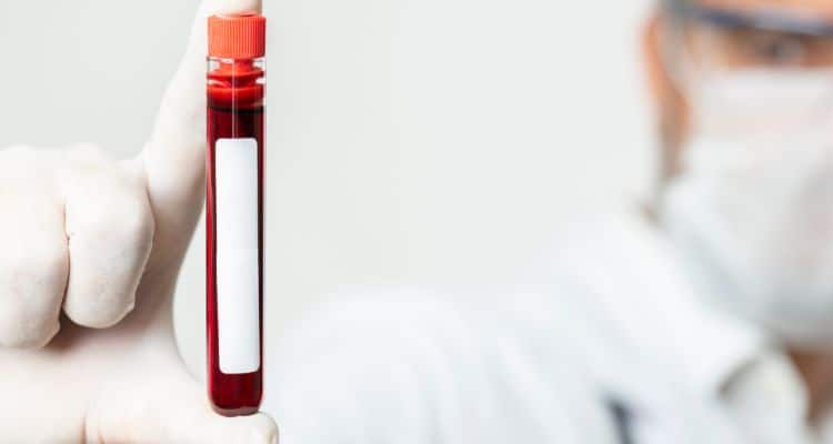 Ultraviolet Blood Irradiation | Benefits & Immune Support Therapy