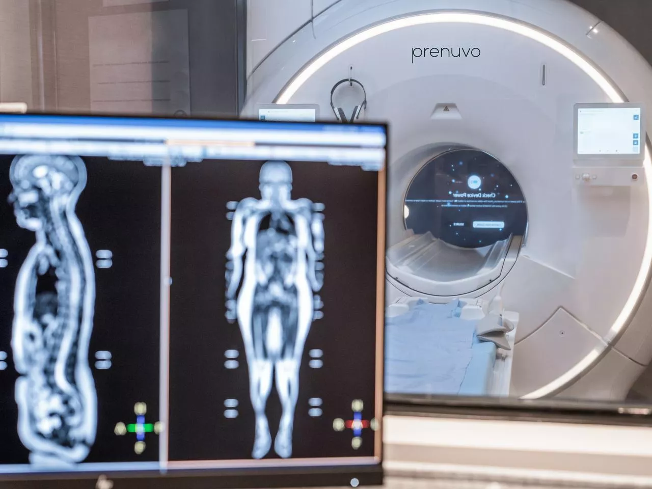 Whole Body MRI For Early Cancer Detection & Medical Review